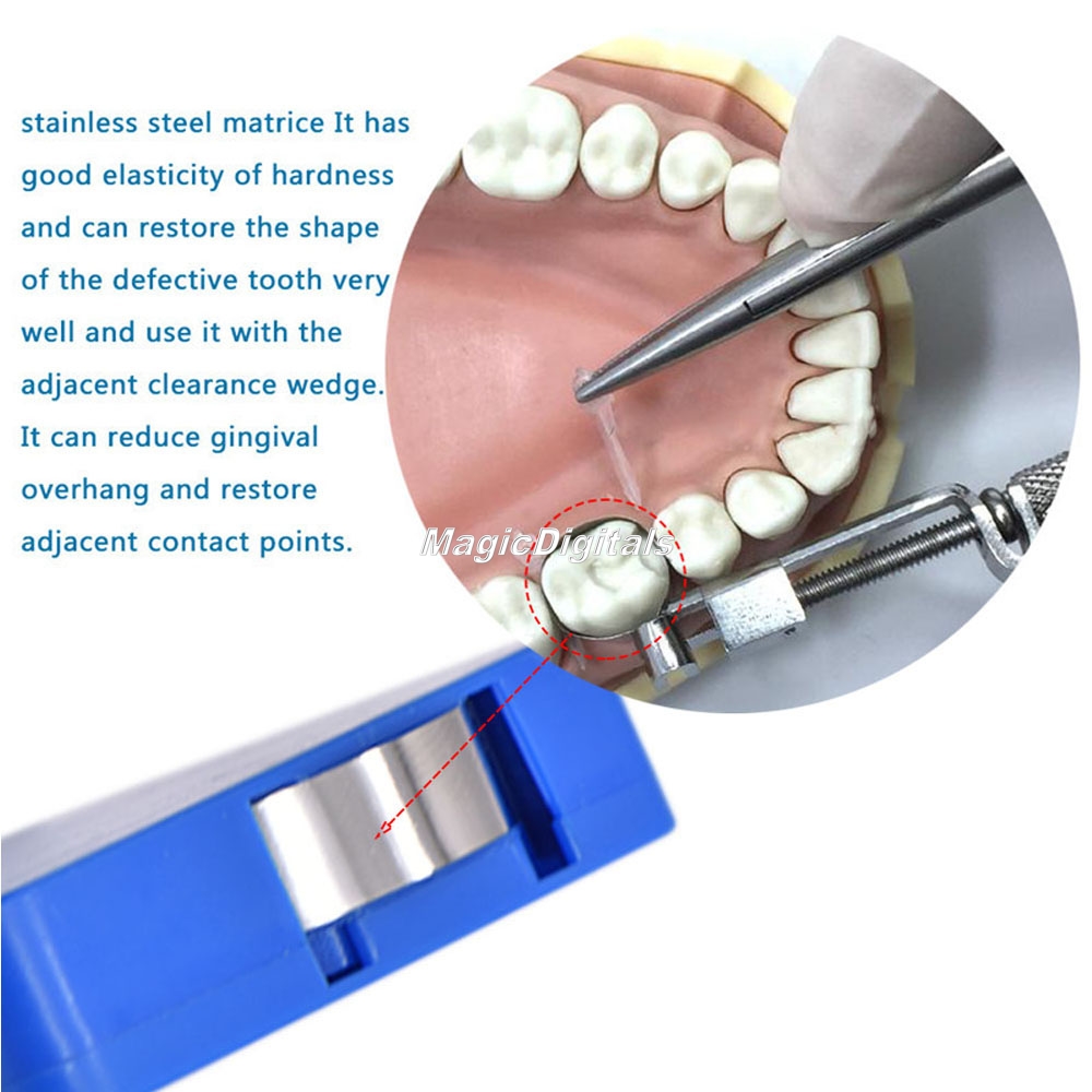 Dental Striproll Stainless Steel Matrix/ Matrice Bands Teeth ...